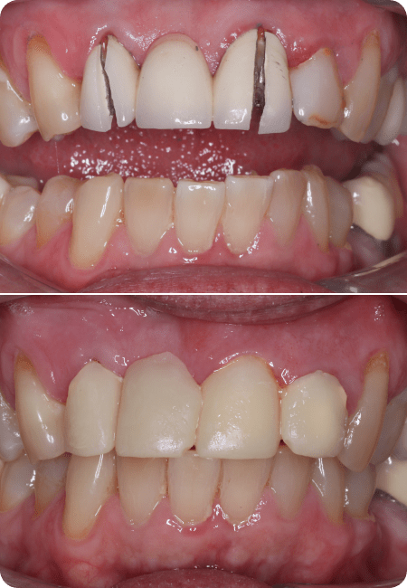 Our Smile Gallery | See the Difference of Smiles with Enso Dental