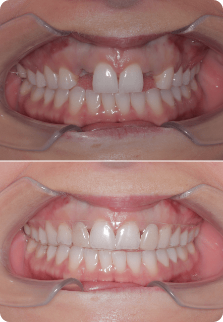 Our Smile Gallery | See the Difference of Smiles with Enso Dental